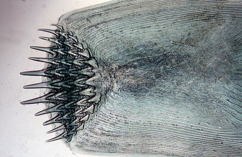 Fish Scale with Spinous Spin Stock Photo - Image of peaks, microscopy ...