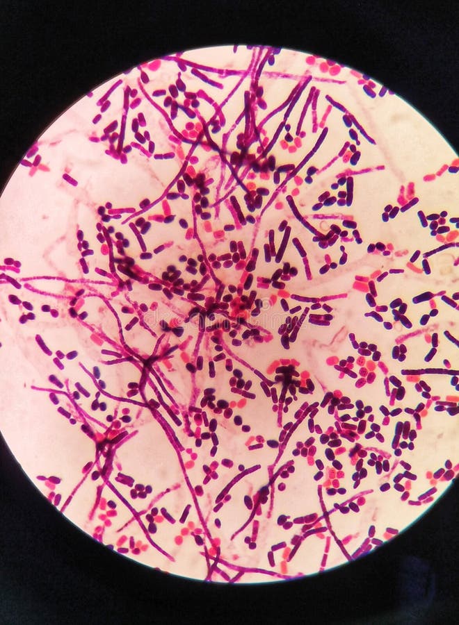 Yeast Cells and Hyphae in Gram Stain Fine with Microscope. Stock Photo ...
