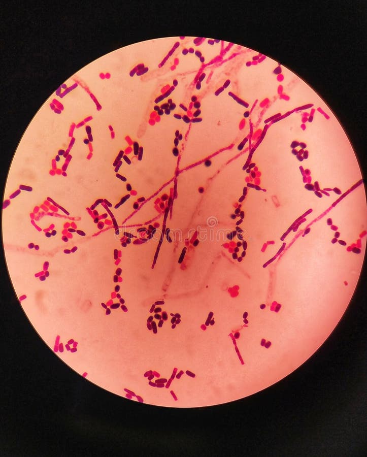 Yeast Cells and Hyphae in Gram Stain Fine with Microscope. Stock Photo ...