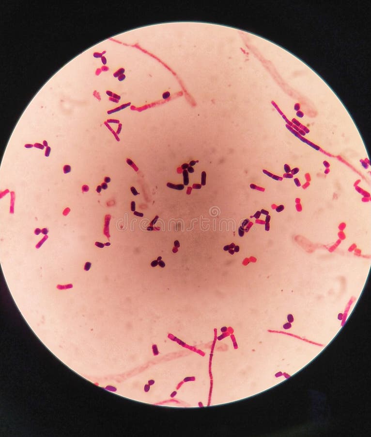 Yeast Cells and Hyphae in Gram Stain Fine with Microscope. Stock Photo ...