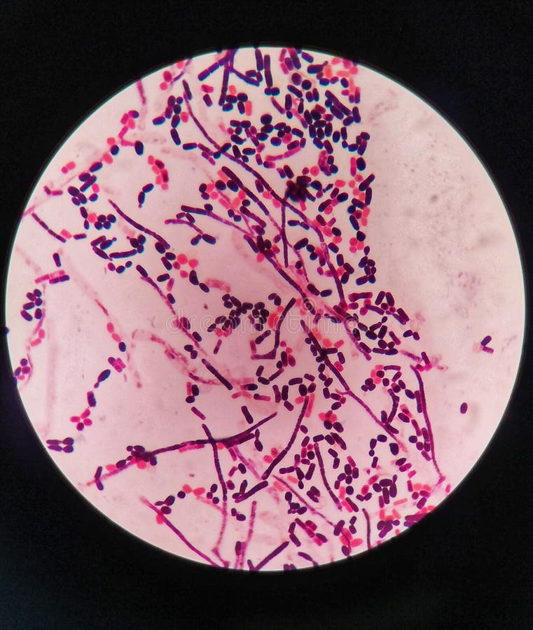 Yeast Cells and Hyphae in Gram Stain Fine with Microscope. Stock Image ...
