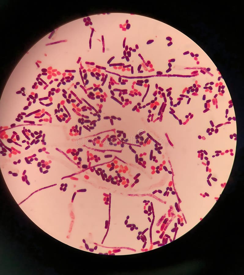 Yeast Cells and Hyphae in Gram Stain Fine with Microscope. Stock Photo ...