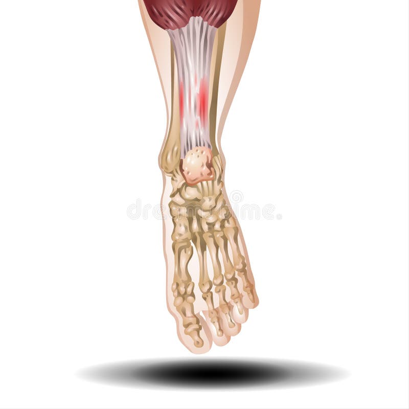 Muscles Feet Diagram Stock Illustrations – 29 Muscles Feet Diagram ...