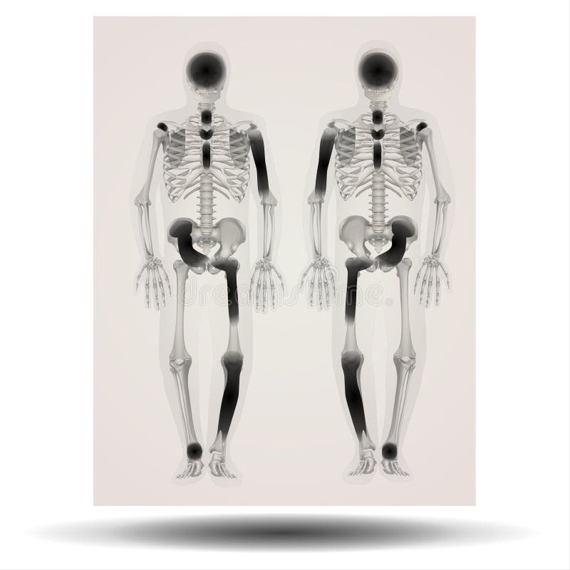X-ray Illustration of a Human Skeleton - Human Body - Science ...