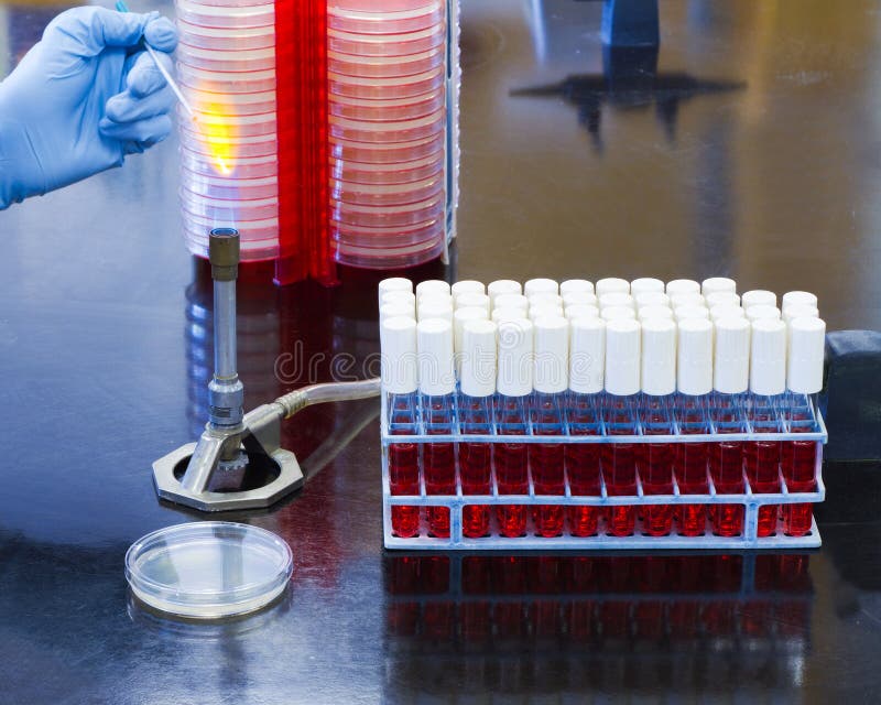 Flaming Loop stock photo. Image of experimental, colonies - 19147720