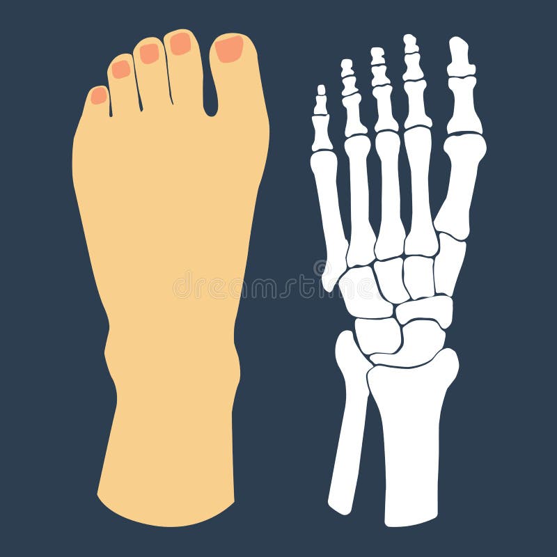 Flat Design of Foot and Skeleton Stock Vector - Illustration of care ...
