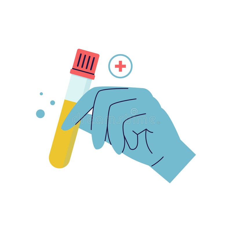 Flat Design of Urine Test Illustration Stock Vector - Illustration of ...