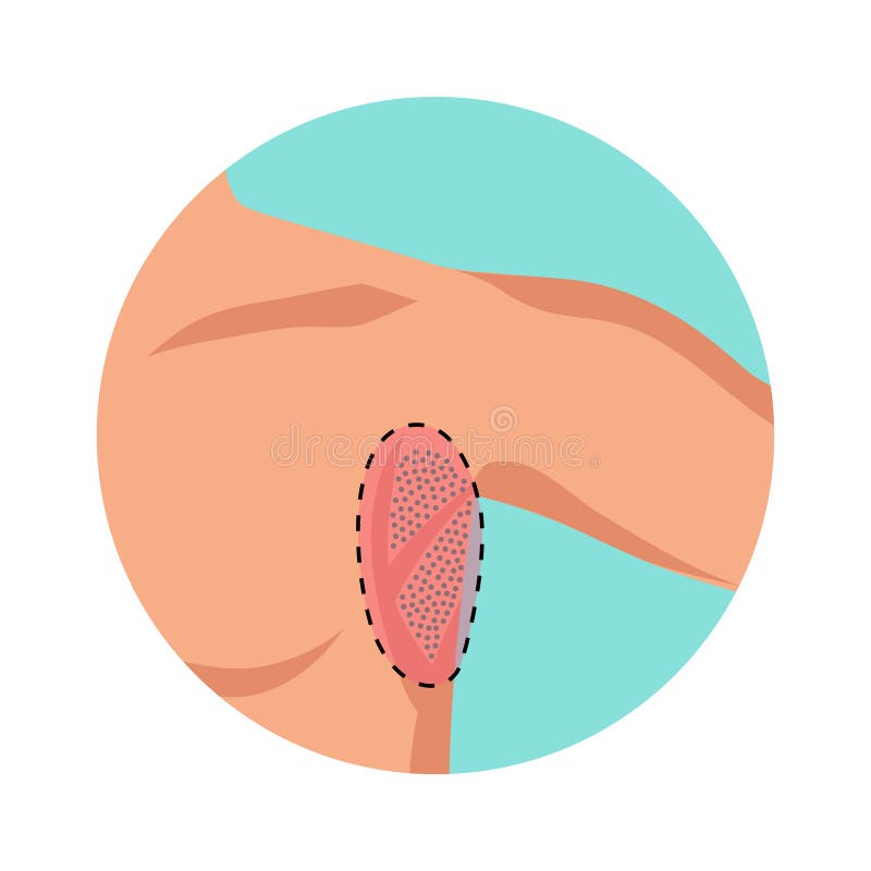Flat Hair Removal stock vector. Illustration of body - 272433887