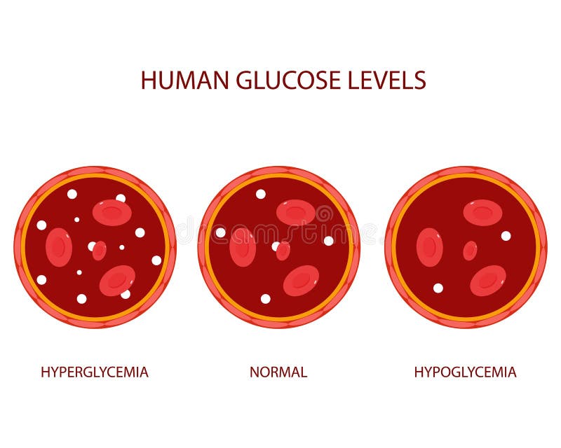Flat Illustrations of Human Glucose Levels Stock Vector - Illustration ...