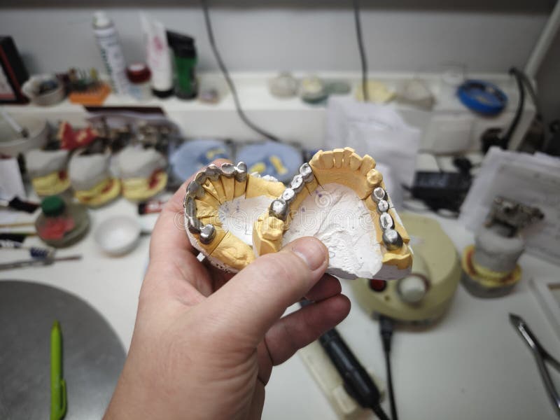 Flat lay tooth crown stock photo. Image of macro, group - 293485434