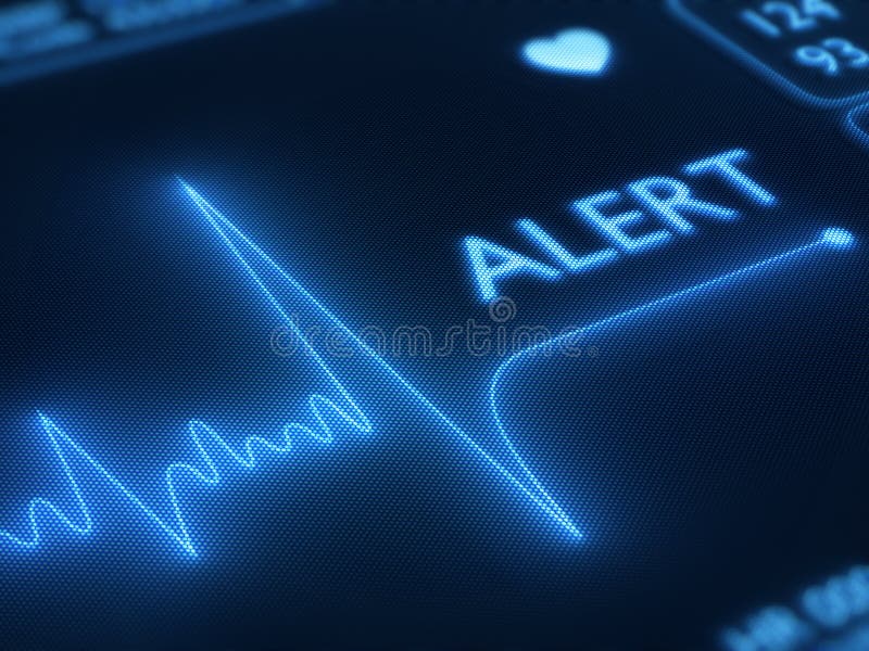 Flat Line Alert on Heart Monitor Stock Illustration - Illustration of ...