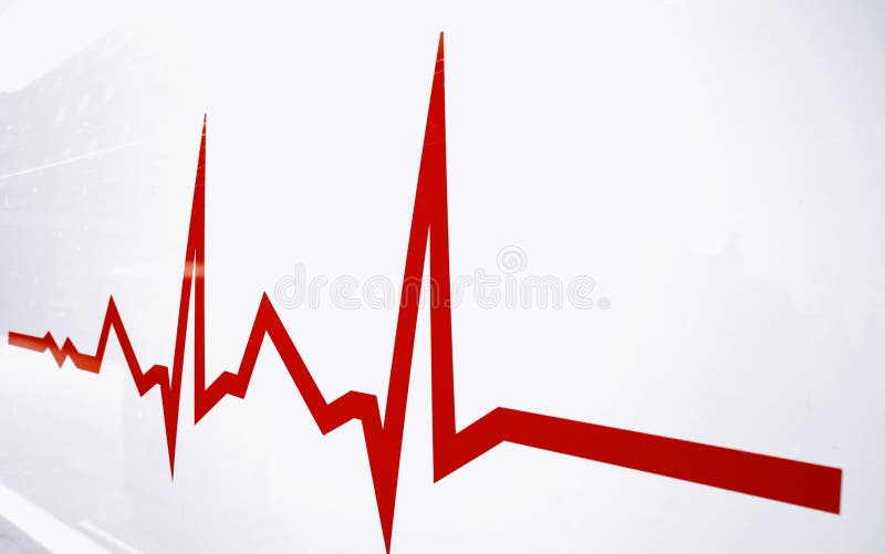 Heart Monitor Flat Line Stock Photos - Free & Royalty-Free Stock Photos ...