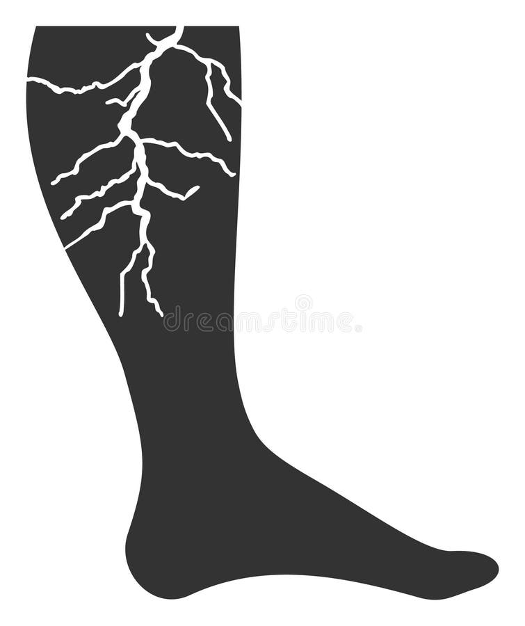 Deep Venous Thrombosis Stock Illustrations – 238 Deep Venous Thrombosis ...