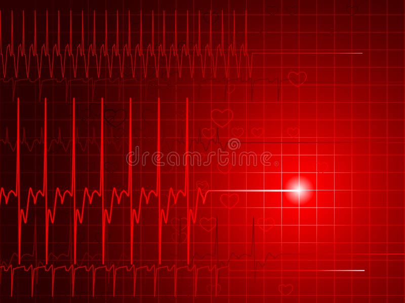 Flatline monitor stock vector. Illustration of death - 14441384