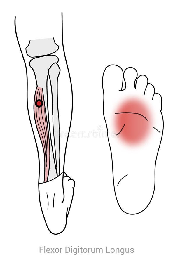 Flexor Digitorum Longus Stock Illustrations – 1,232 Flexor Digitorum ...