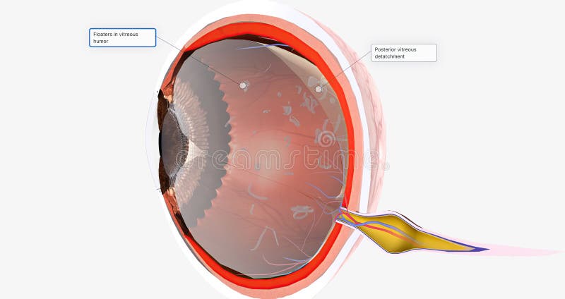 Floaters are Small Spots in Your Field of Vision Stock Illustration ...