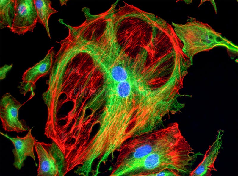 Fluorescence Microscope Image of Cells Undergoing Mitosis Stock Image ...