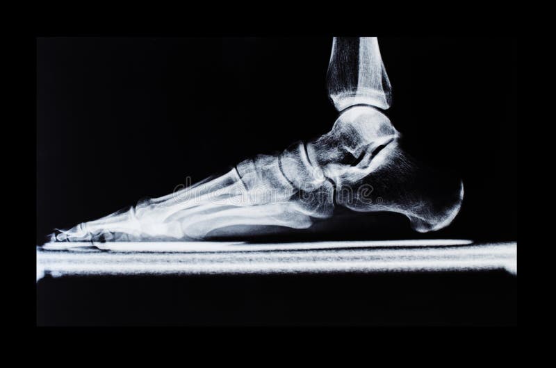 Fluorography And Healthcare. Adult Man Examination Stock Image - Image ...