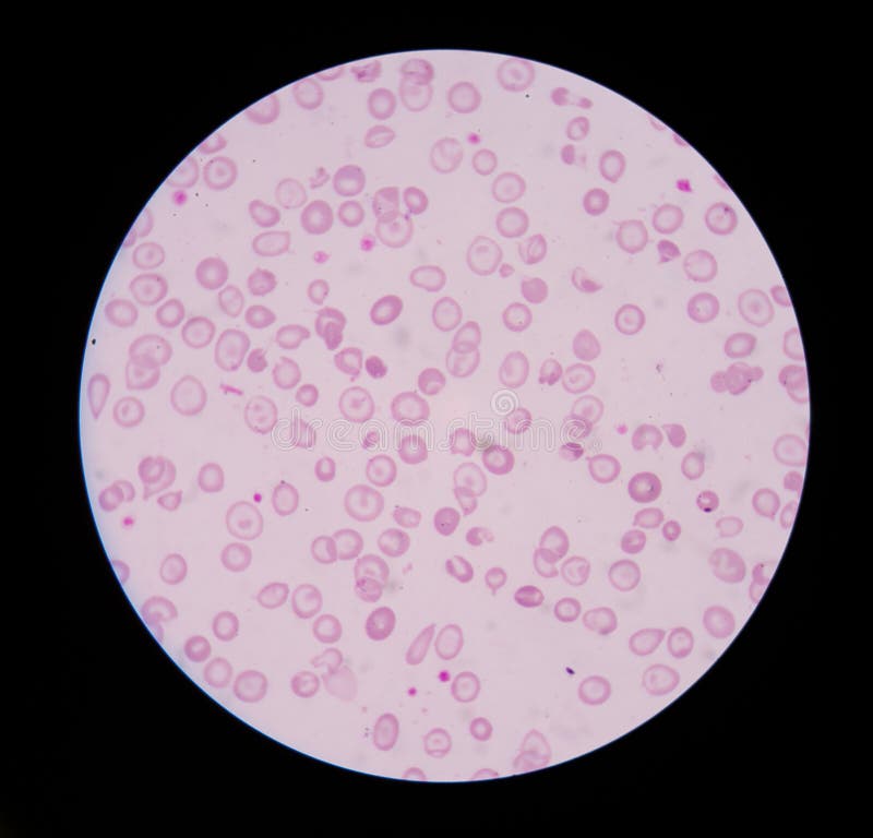 Fond Anormal De La Science De Globules Rouges Photo stock - Image du ...