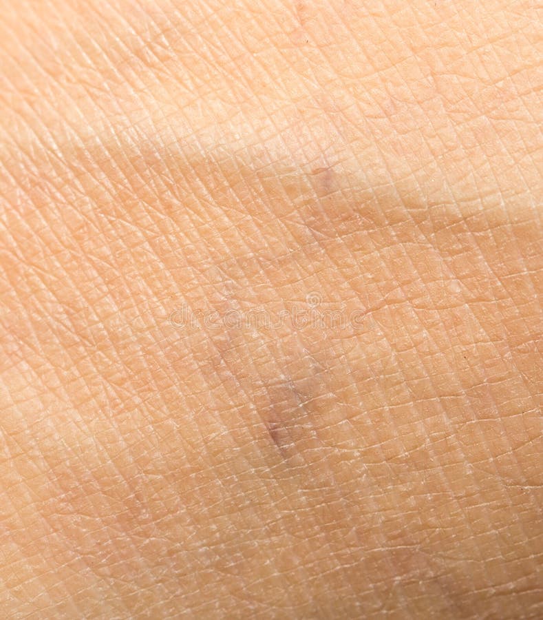 Fondo de la piel humana imagen de archivo. Imagen de humano - 100912523