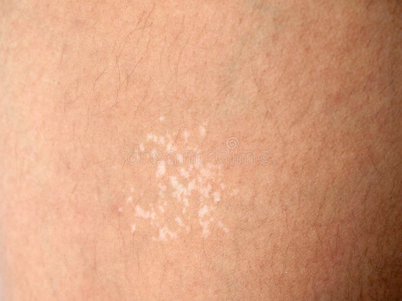 Fondo de la piel humana imagen de archivo. Imagen de macro - 141767413