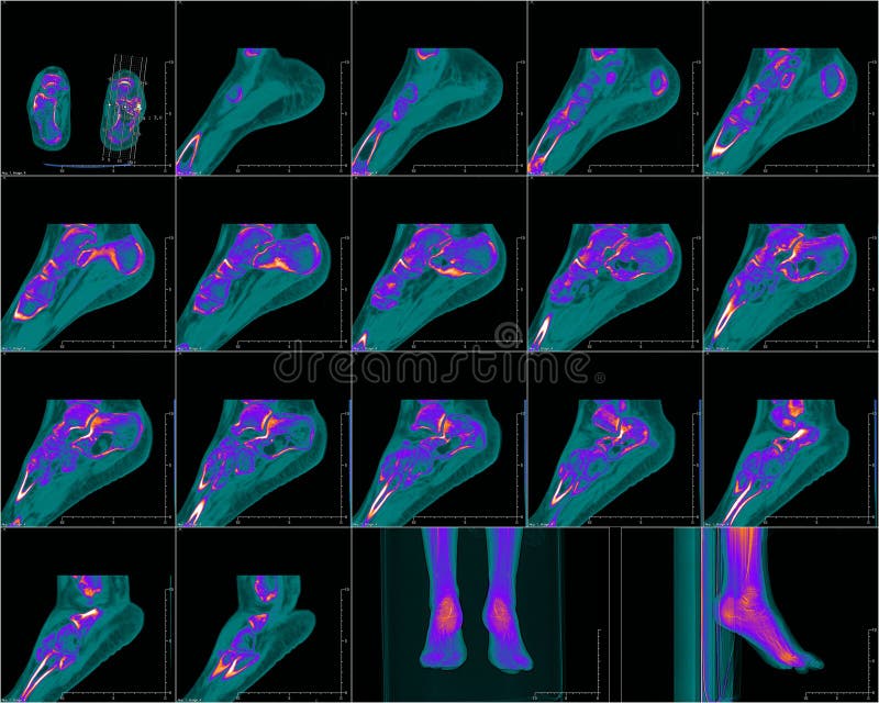 Foot Ct Stock Photos - Free & Royalty-Free Stock Photos from Dreamstime