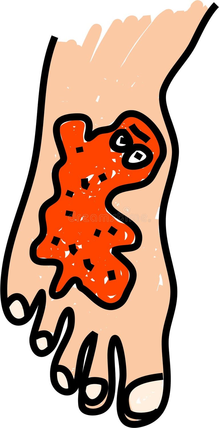 Foot Bacteria Stock Illustrations – 581 Foot Bacteria Stock ...