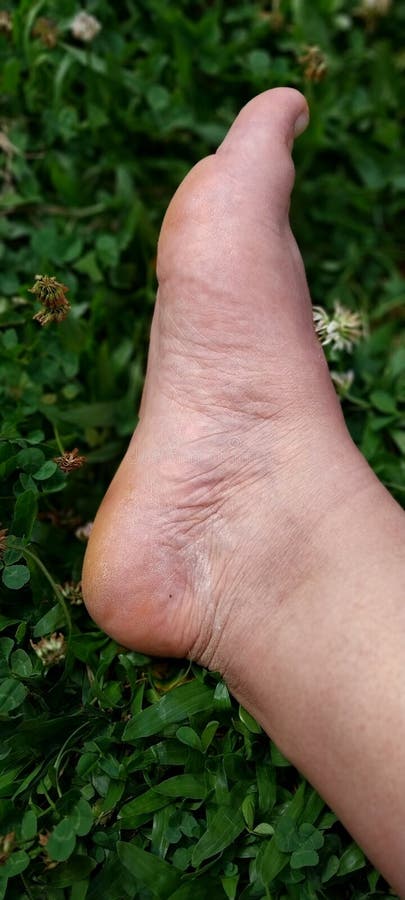 A Foot in a Grass in a Relax Moment Stock Photo - Image of moment, foot ...
