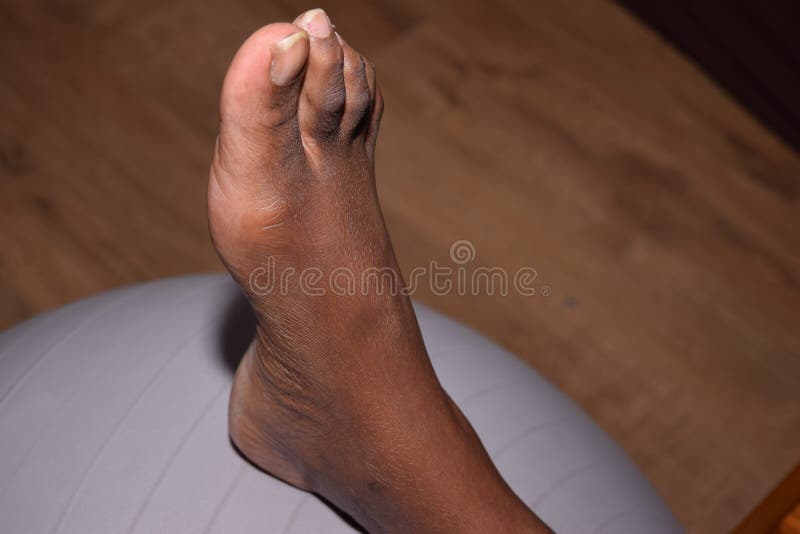 African Female Foot on a Ball Stock Photo - Image of foot, grey: 82371088