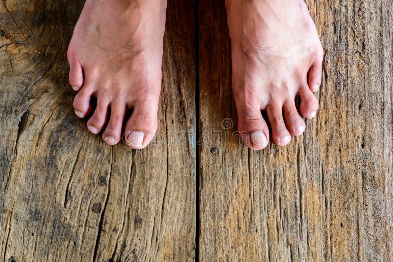 Wood Texture Green Trees and Leaf Greenery Bokeh Stock Image - Image of ...