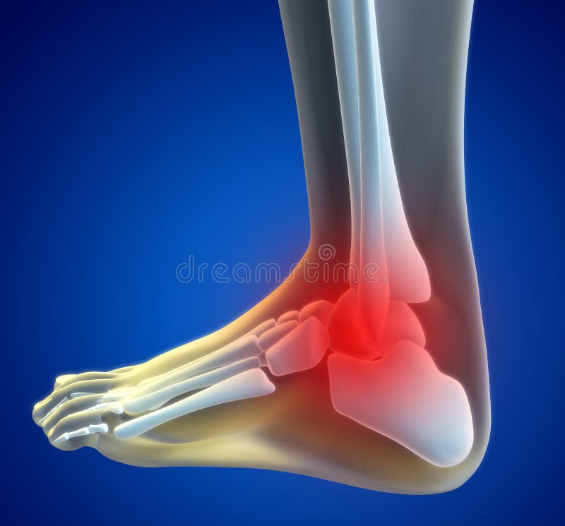 Foot Pain stock illustration. Illustration of female - 14390016