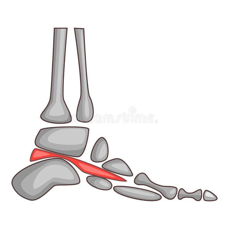 Foot Problem Icon, Cartoon Style Stock Vector - Illustration of ...