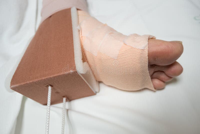 Foot of the patient stock photo. Image of infirm, clinic - 173971160