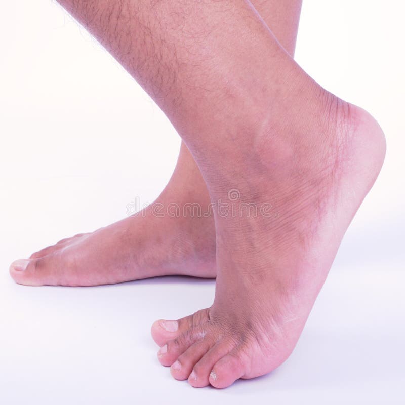 Foot skin stock image. Image of white, healthy, human - 68552399