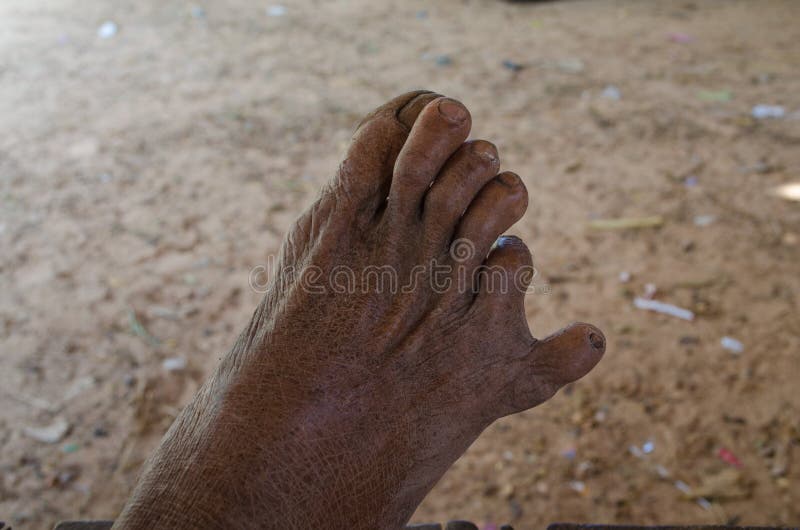 Bare Foot Old Man Stock Photos - Download 194 Royalty Free Photos