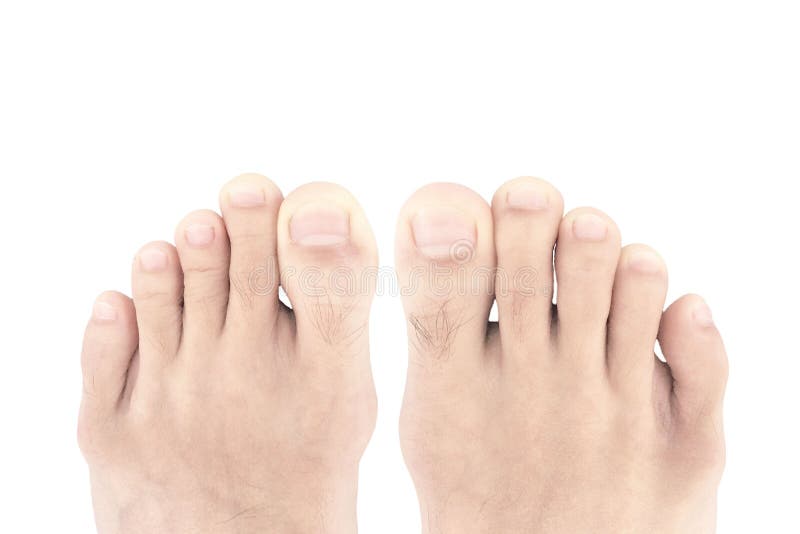 Foot And Toe Of Young Man Isolate On White Background Stock Photo ...