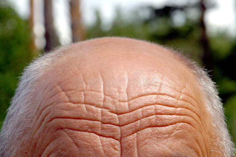 Forehead Stock Images - Image: 4232144