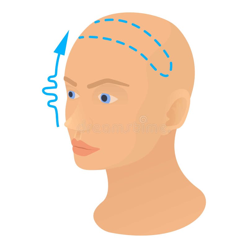 Forehead Lift Icon, Cartoon Style Stock Vector - Illustration of girl ...