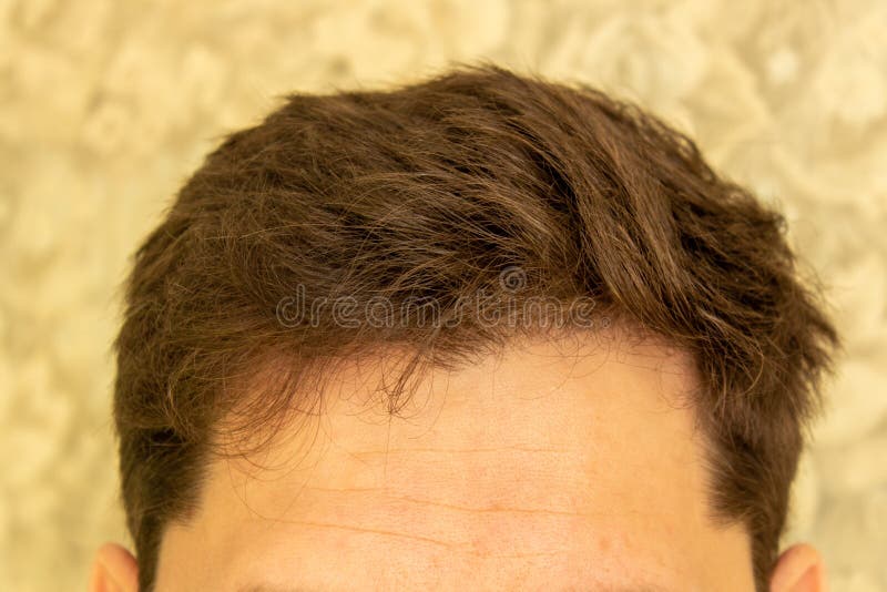 Forehead, Upper Part of a Man`s Face Stock Image - Image of casual ...