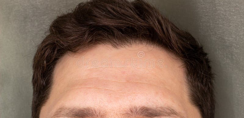 Forehead, Upper Part of a Man`s Face Stock Photo - Image of hairdress ...