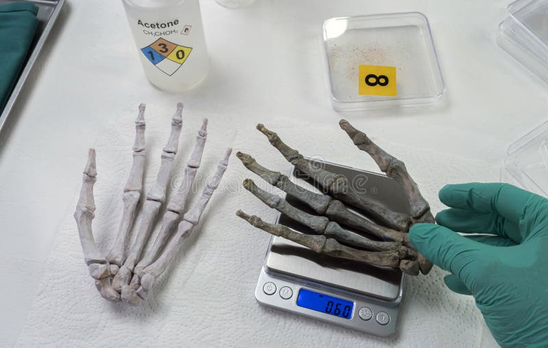 Forensic Scientist Weighs Right Hand of Human Skeleton on a Scale To ...
