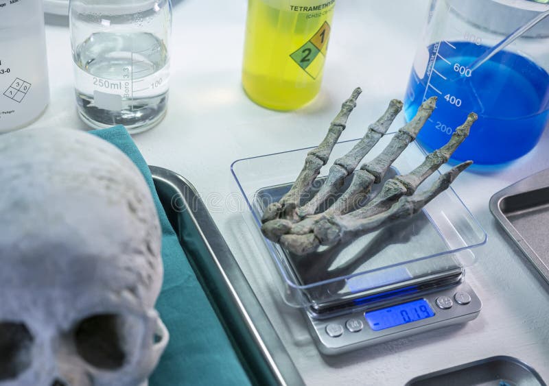 Forensic Scientist Weighs Right Hand of Human Skeleton on a Scale To ...