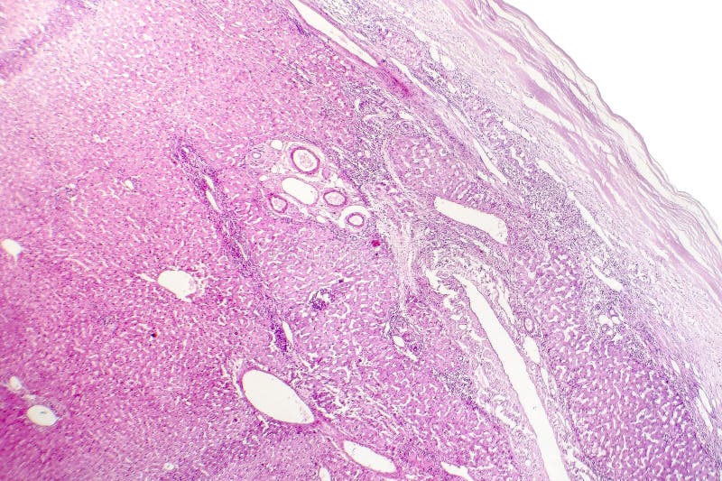 Formation de kyste de foie photo stock. Image du microscopie - 122814266