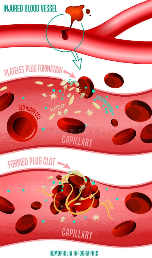 Formazione Del Coagulo Di Sangue Illustrazione Vettoriale ...