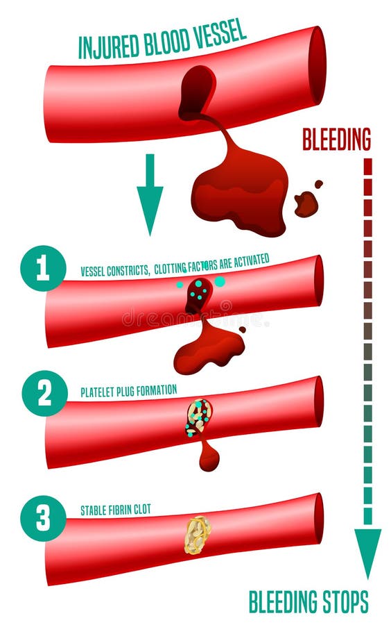 Formazione Del Coagulo Di Sangue Illustrazione Vettoriale ...