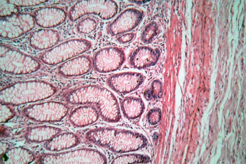 Darmcellen Onder De Microscoop Stock Foto - Image of micro, gezond ...