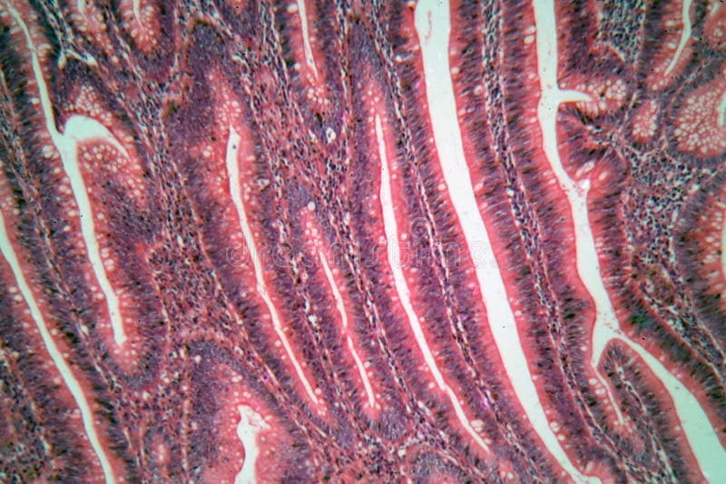 Darm-Zellen Unter Dem Mikroskop Stockbild - Bild von mikroskopie ...