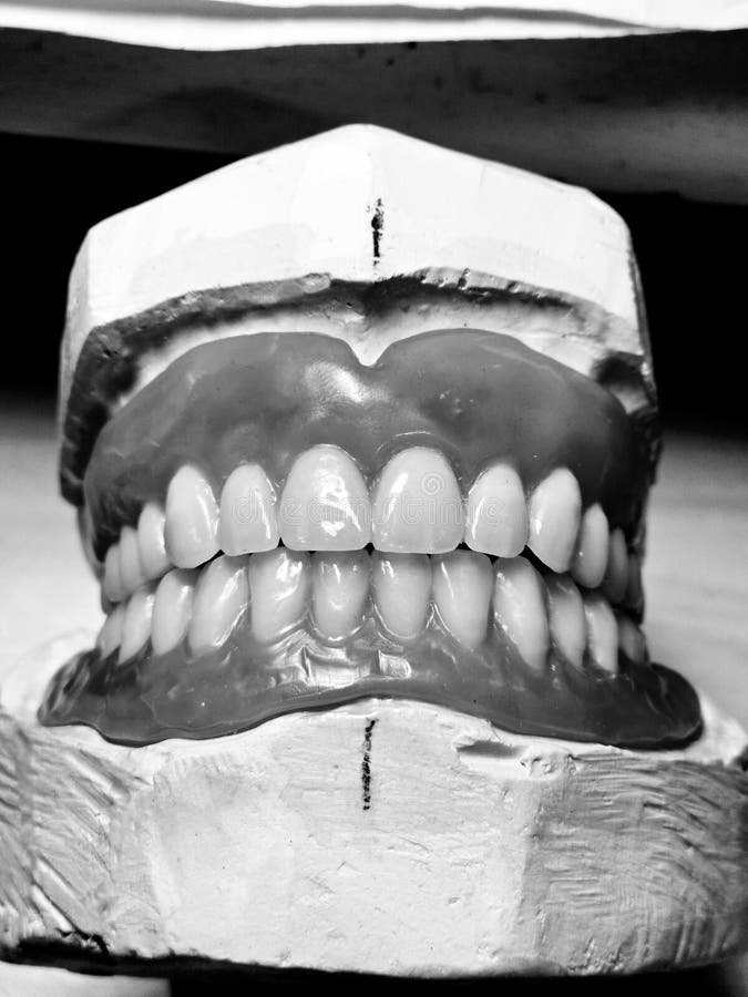 Fotos De Dentaduras En Cera. Imagen de archivo - Imagen de médico ...