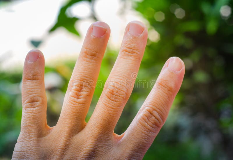 Four Fingers of the Left Hand Stock Photo - Image of nature, sunlight ...