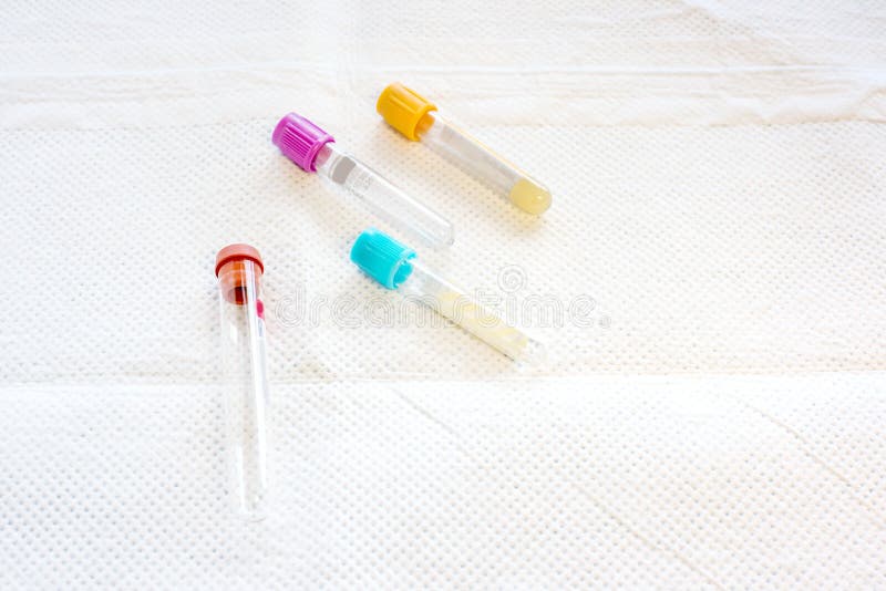 Four Test Tubes With Red, Yellow And Blue Liquid On A White Background ...